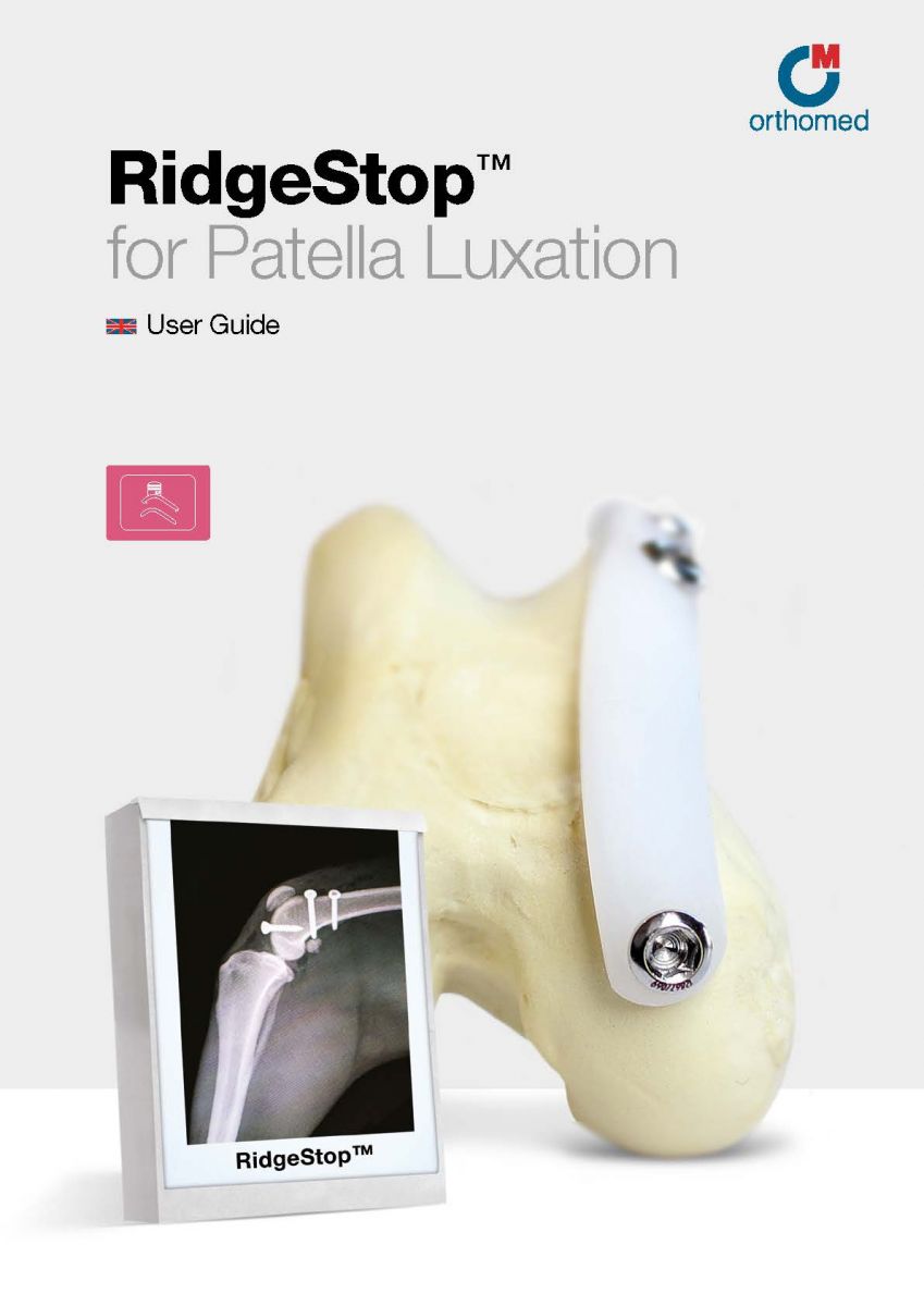RidgeStop™ Implant - Left Lateral, Right Medial